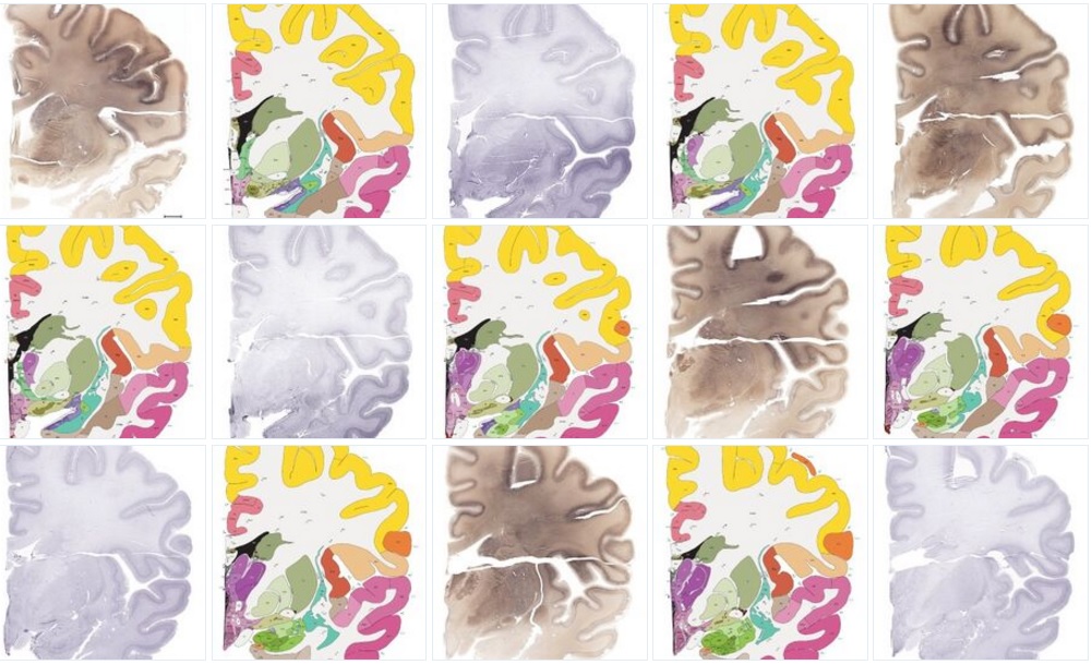 Brain atlas gets printed … all 350 pages’ worth – Cosmic Log